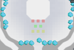 Vorkath Tile Markers - OSRS - Old School RuneScape Guides - Beginner ...